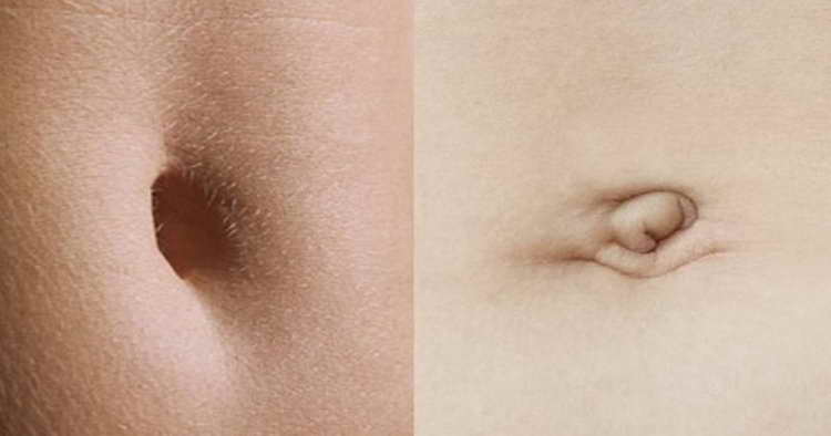Awesome News: Have You Ever Wondered Why Your Belly Button Is An Innie ... Awesome News: Have You Ever Wondered Why Your Belly Button Is An Innie ...